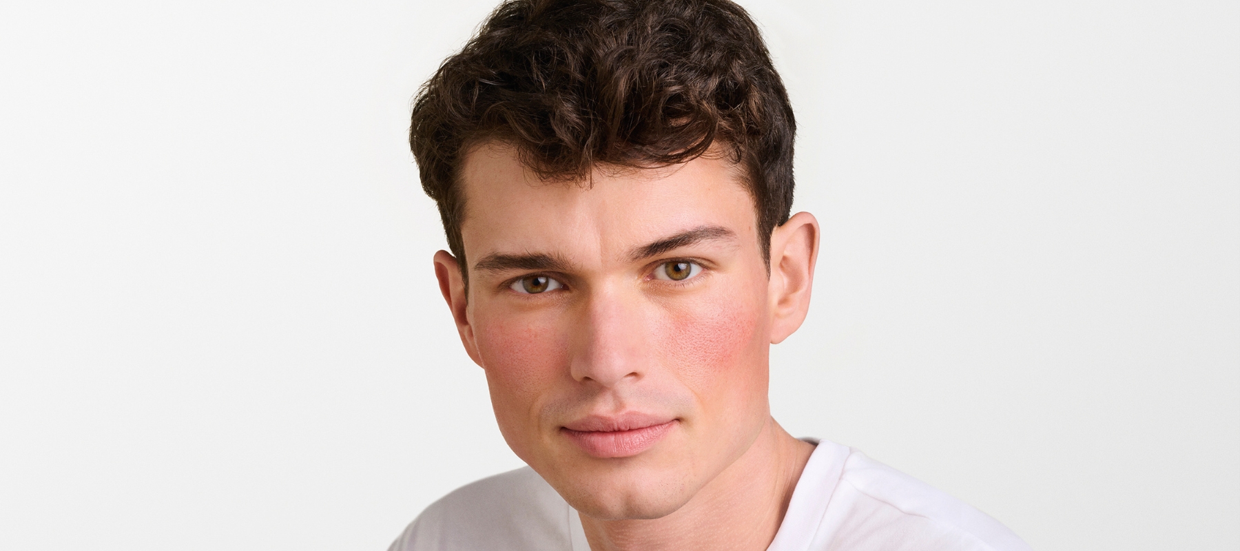 La couperose au visage : quel traitement pour la rosacée ? | Bioderma ...