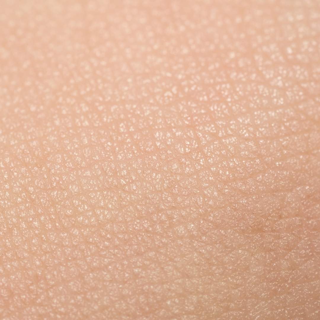 Peau sèche : 3 types de sécheresse à traiter | Bioderma France