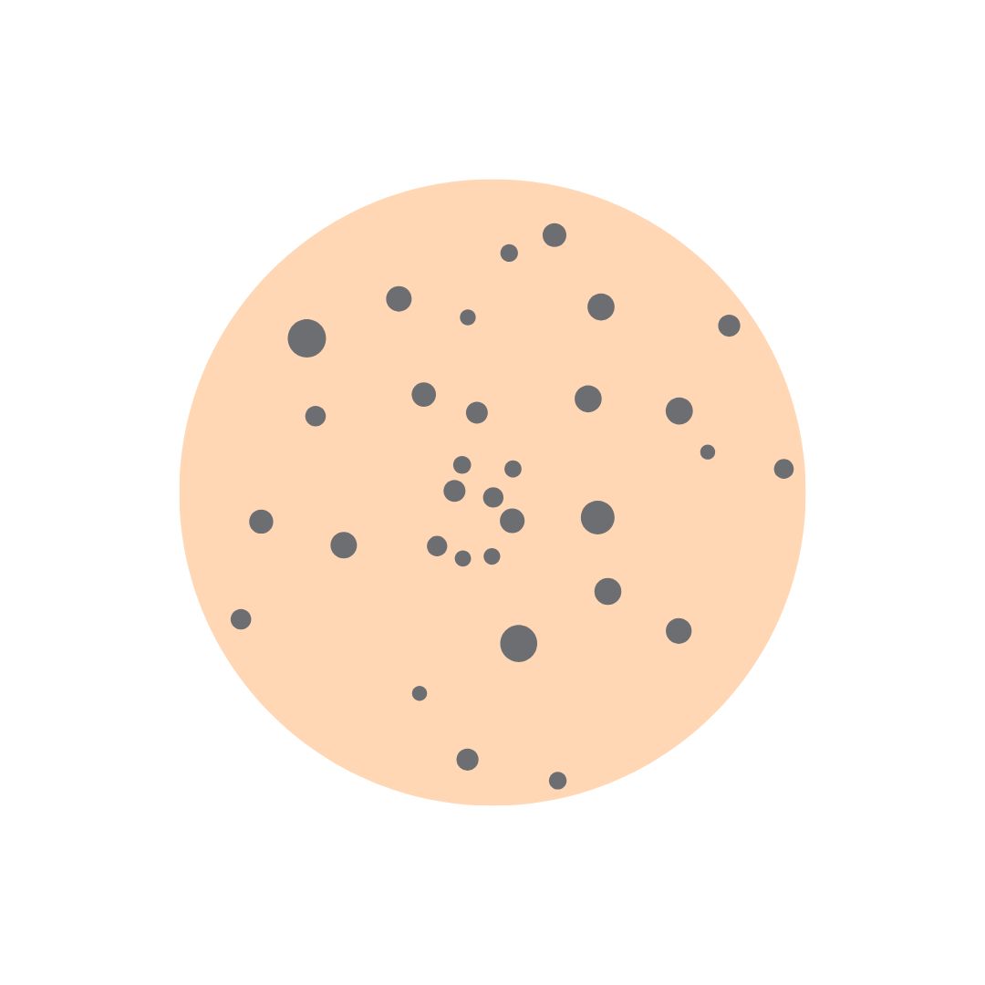 Comédons : tout savoir sur les points noirs et microkystes