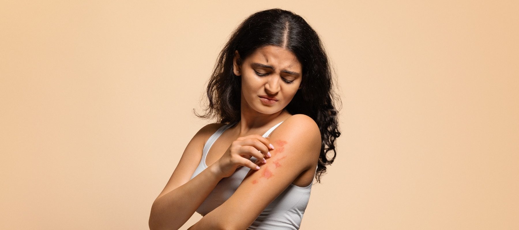 Dermite séborrhéique : Cause, symptôme, traitement | Bioderma France